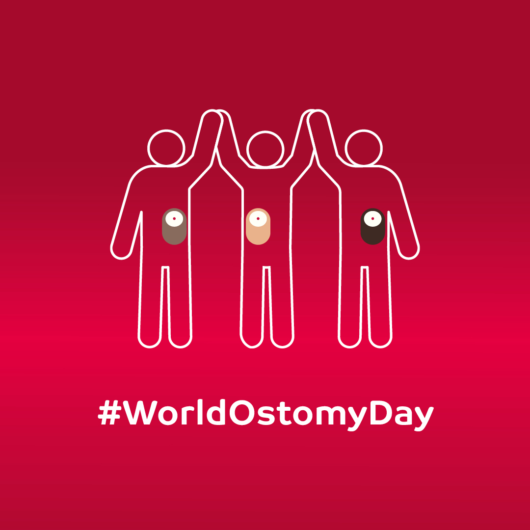 Fascinating facts about stomas - Trio Healthcare
